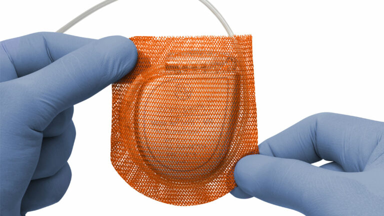 Noticias – EOS Ecuador